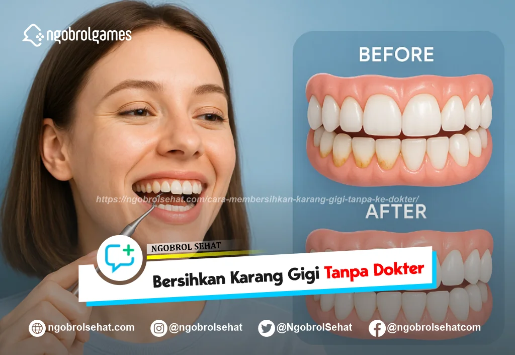 Cara Membersihkan Karang Gigi Tanpa ke Dokter